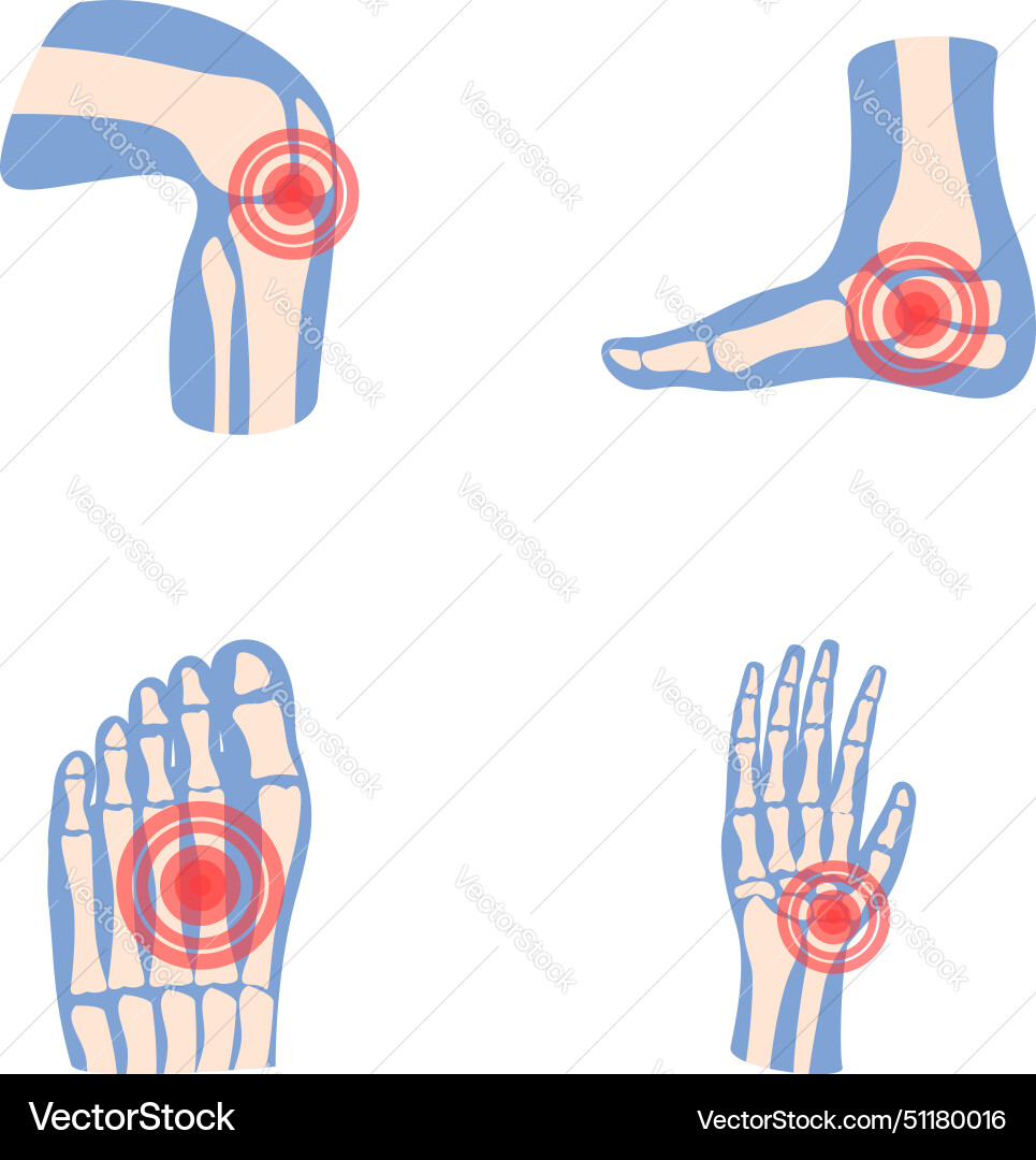 Arthritis icons set cartoon human joint Royalty Free Vector