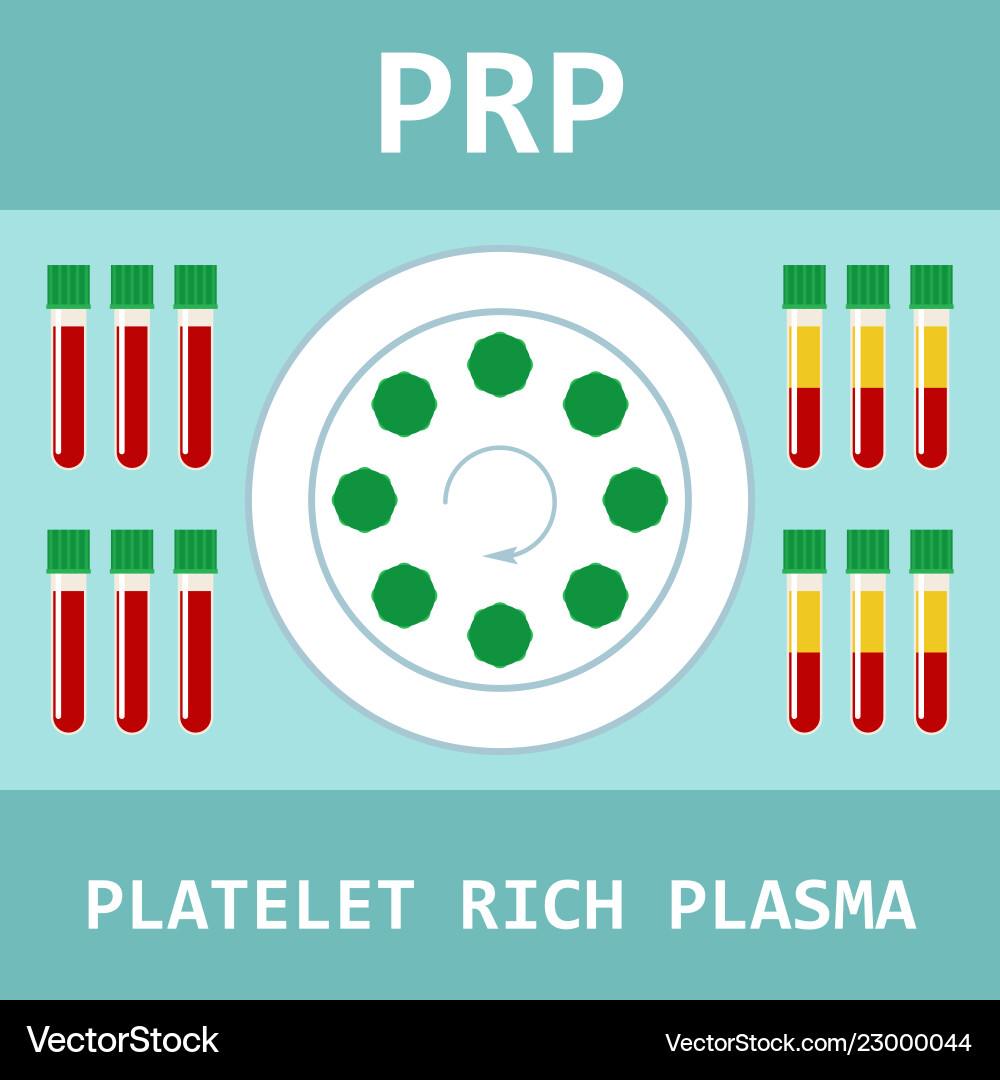 Platelet rich plasma prp method Royalty Free Vector Image
