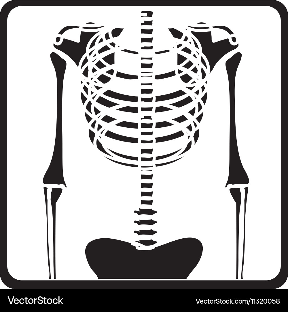 Chest x-ray icon image Royalty Free Vector Image