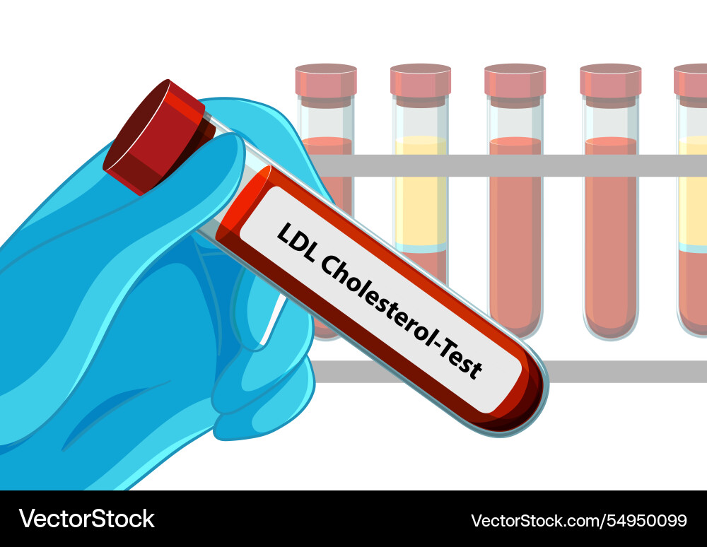 Ldl cholesterol test in laboratory Royalty Free Vector Image