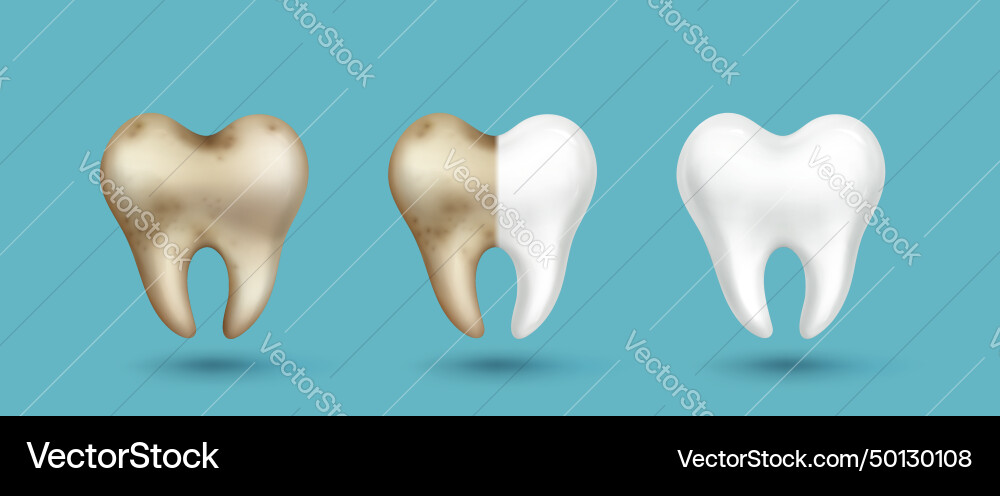 Realistic tooth - dirty gray and clean white Vector Image