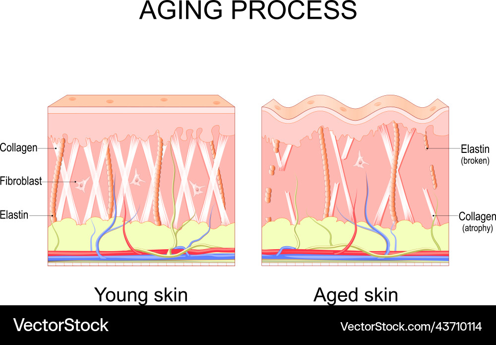 Aging process comparison of young and aged skin Vector Image