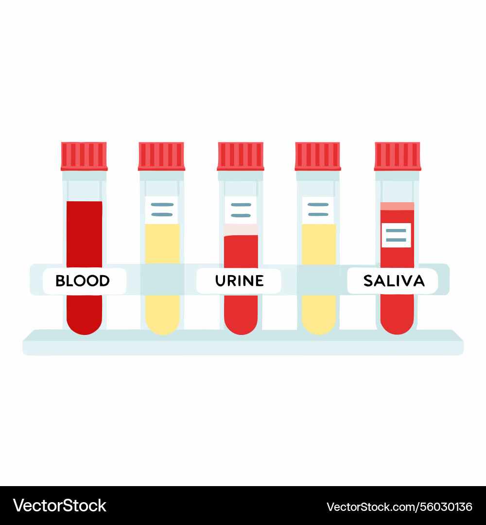 Medical sample tubes rack with blood urine Vector Image