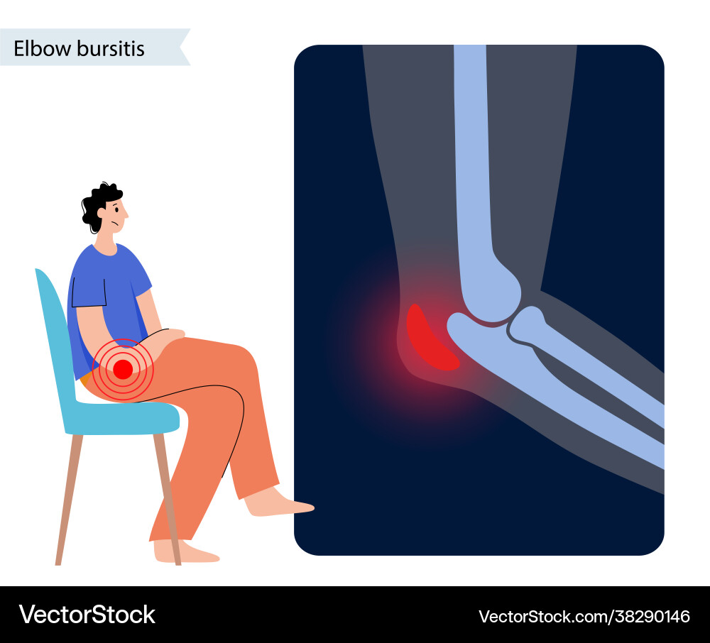 Student elbow bursitis Royalty Free Vector Image