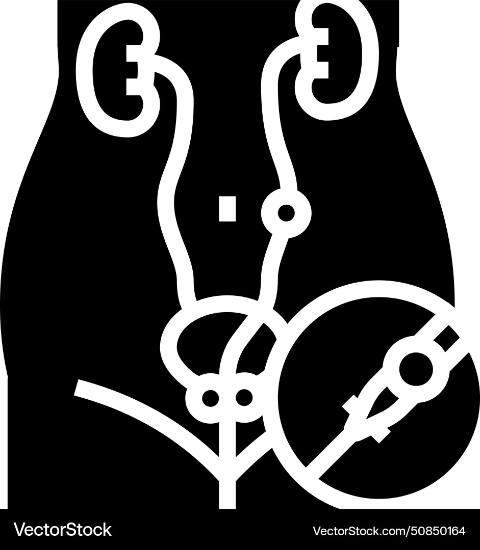 Ureteroscopy urology glyph icon Royalty Free Vector Image