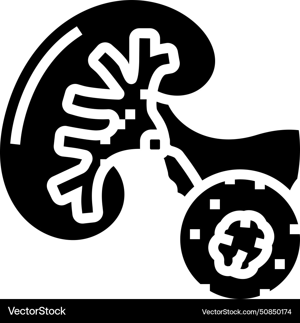 Urolithiasis urology glyph icon Royalty Free Vector Image