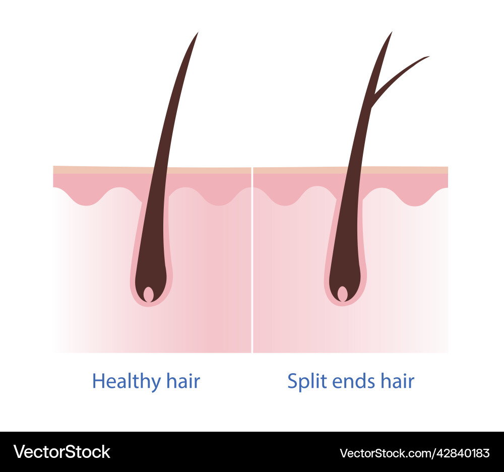 Healthy hair and split ends with scalp layer Vector Image