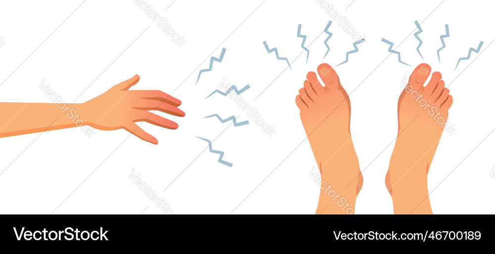 Numbness in Hands and Feet Royalty Free Vector Image