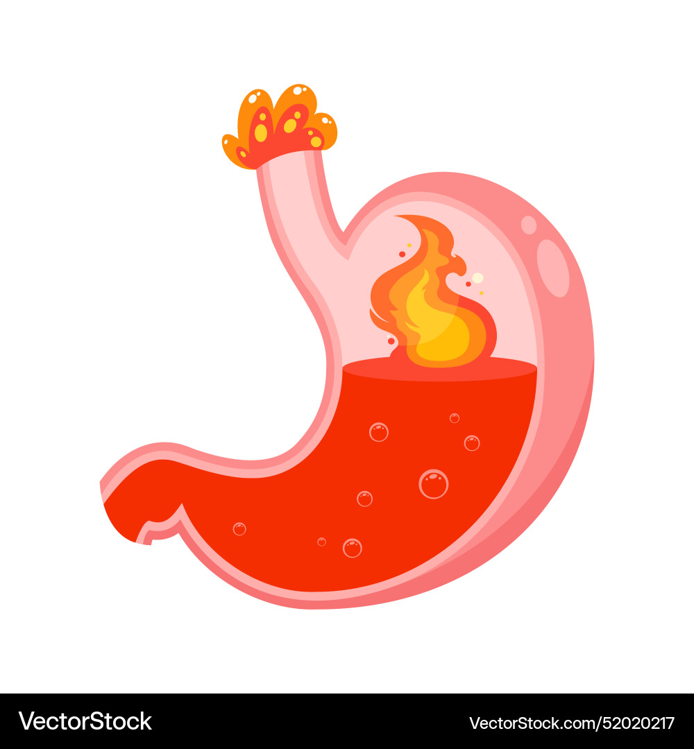 Stomach acid fire Royalty Free Vector Image - VectorStock