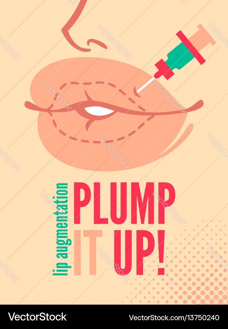 Giant Lips - Lip Augmentation Royalty Free Vector Image