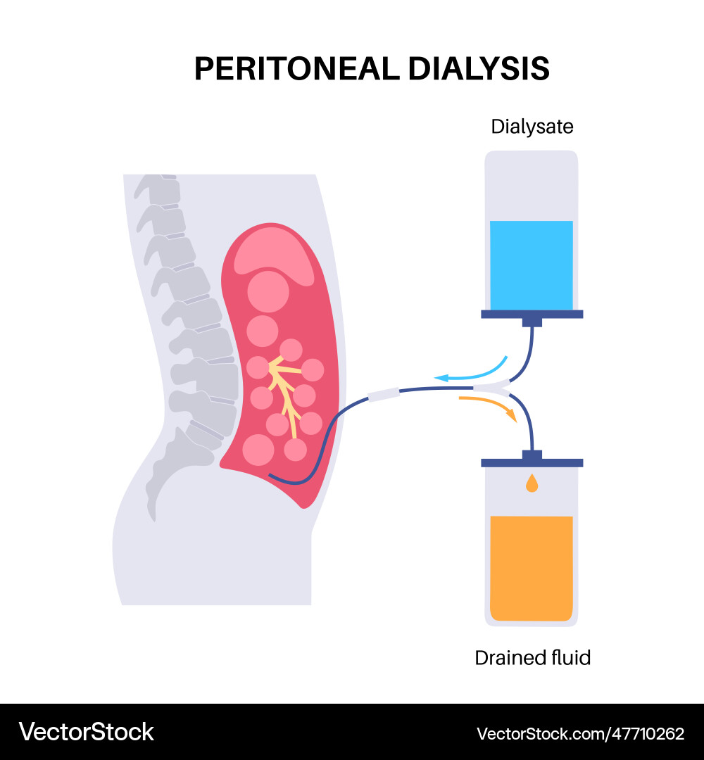 Peritoneum Vector Images (over 100)