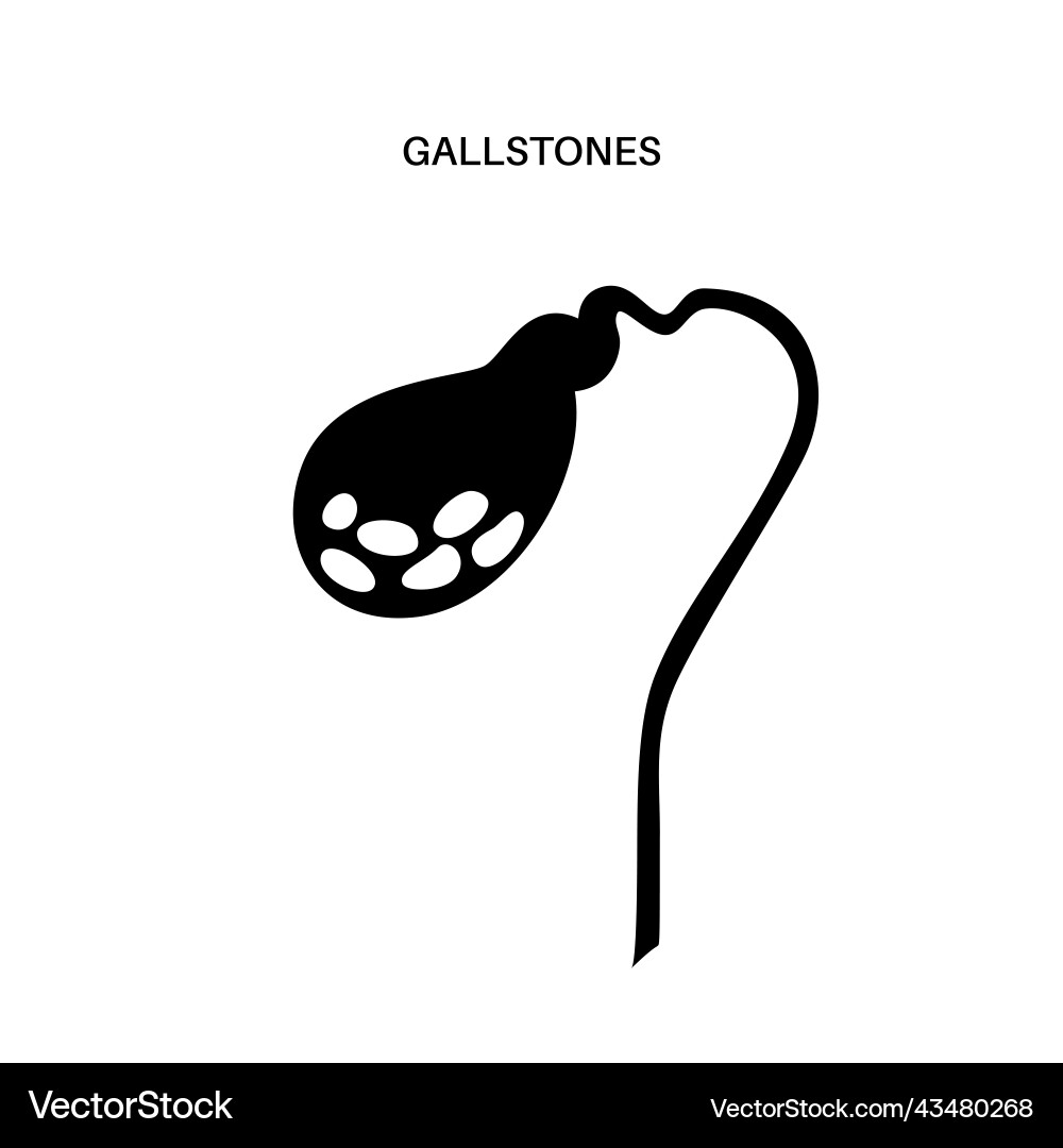 Gallbladder stones anatomy Royalty Free Vector Image