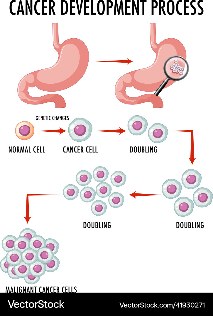 Diagram showing cancer development process Vector Image