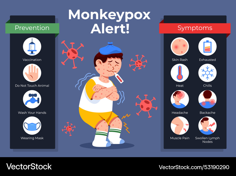 Young boy infected monkeypox Royalty Free Vector Image
