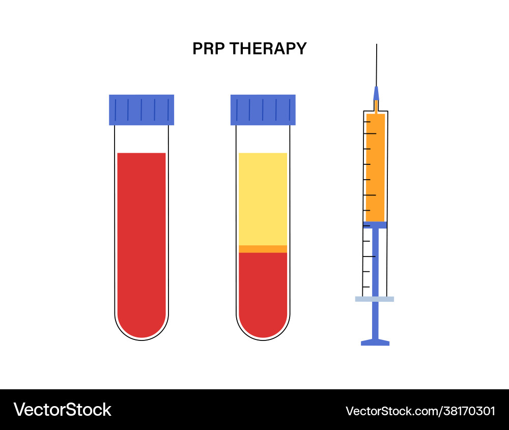 Platelet Rich Plasma Vector Images (over 150)