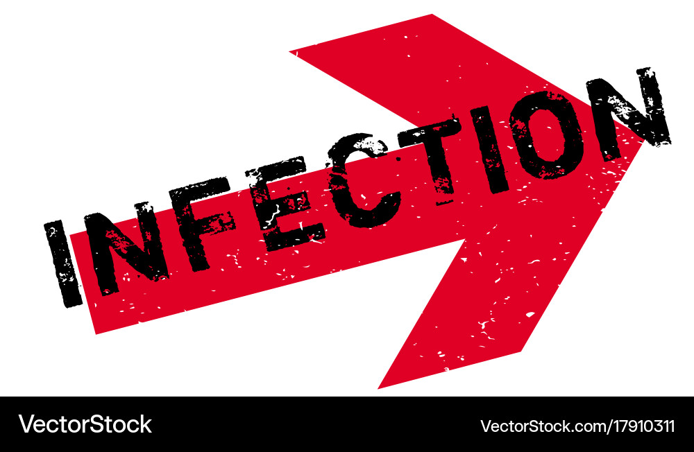 Infection rubber stamp Royalty Free Vector Image