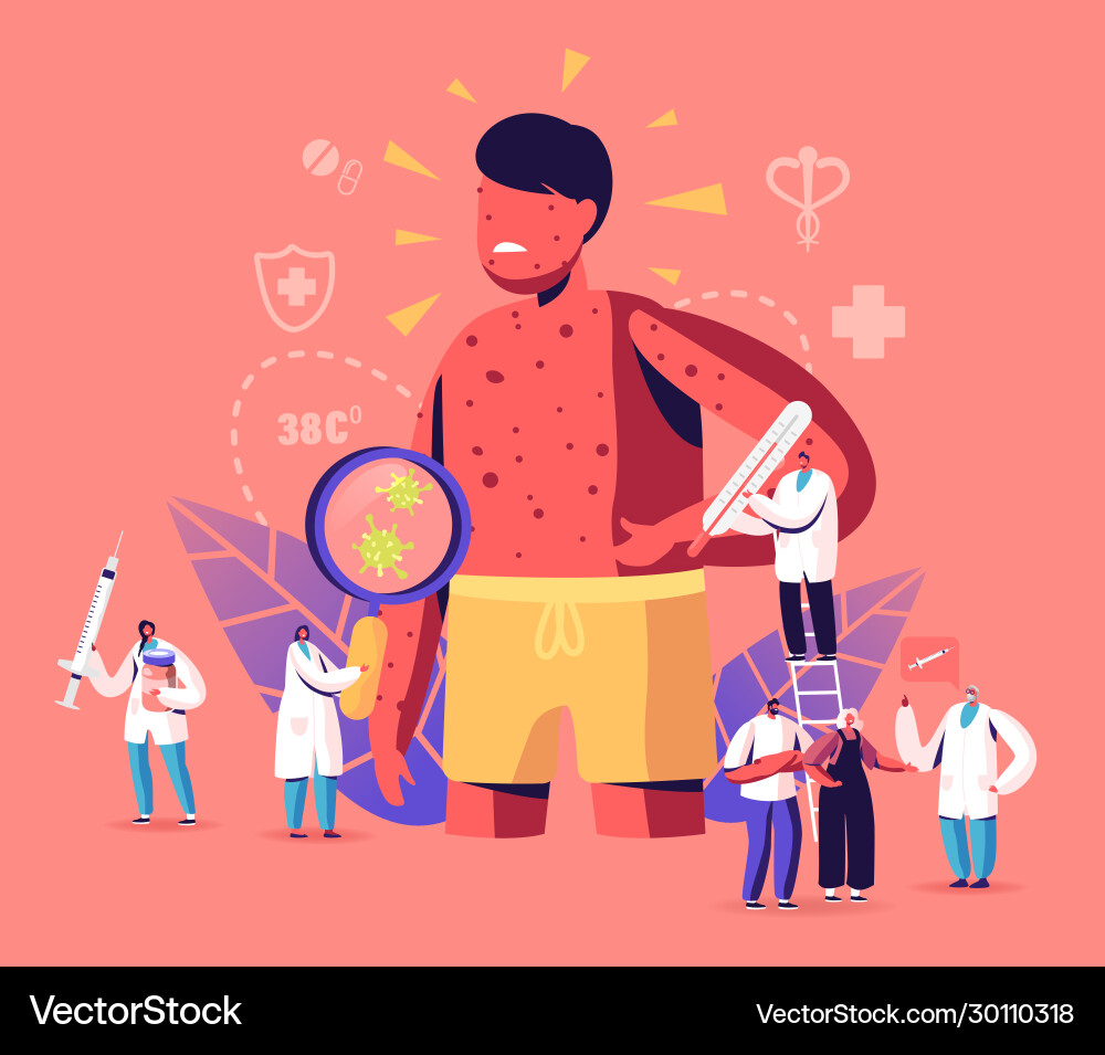 Chicken pox varicella symptoms concept tiny Vector Image