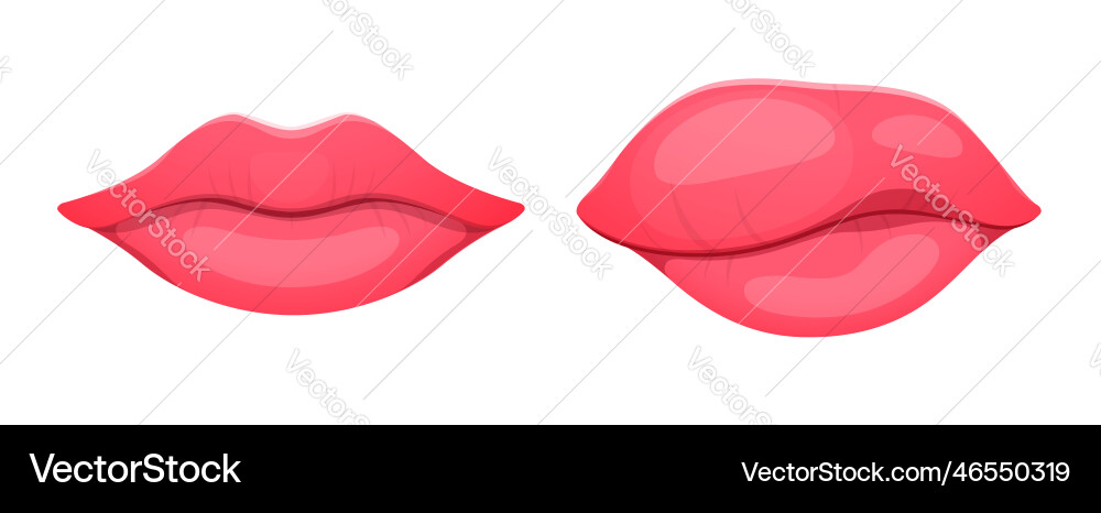 Lip Swelling - Angioedema Symptoms Royalty Free Vector Image