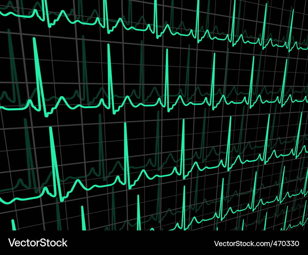 Cardiac Monitoring Trace Royalty Free Vector Image