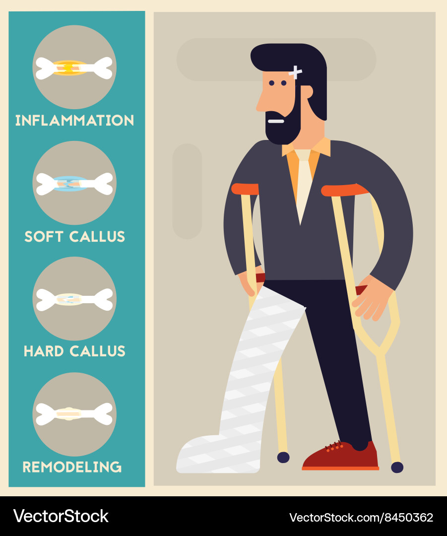 Bone fracture character cartoon Royalty Free Vector Image