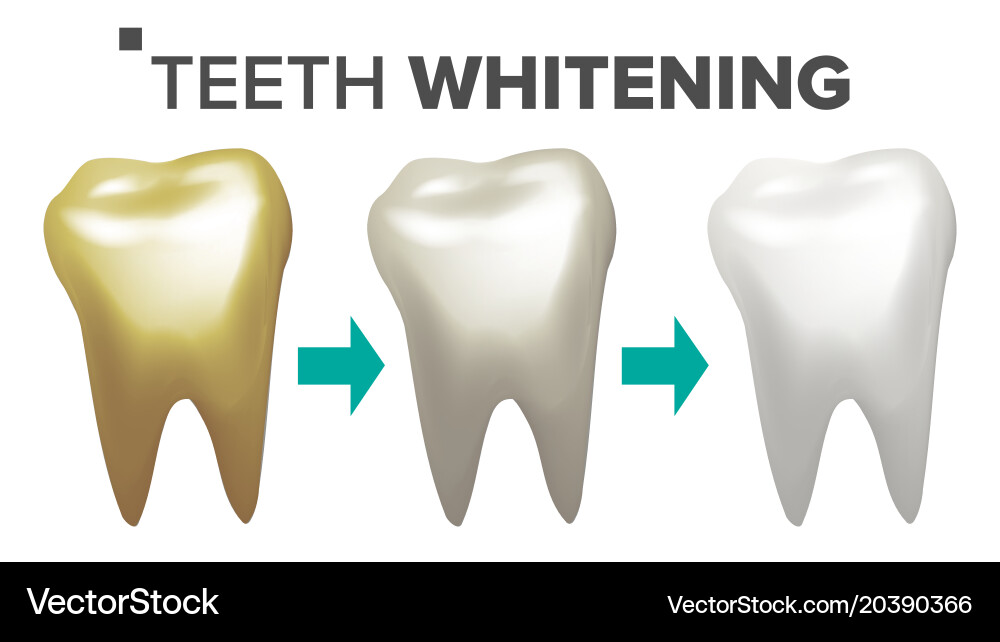 Teeth whitening and tooth dental Royalty Free Vector Image