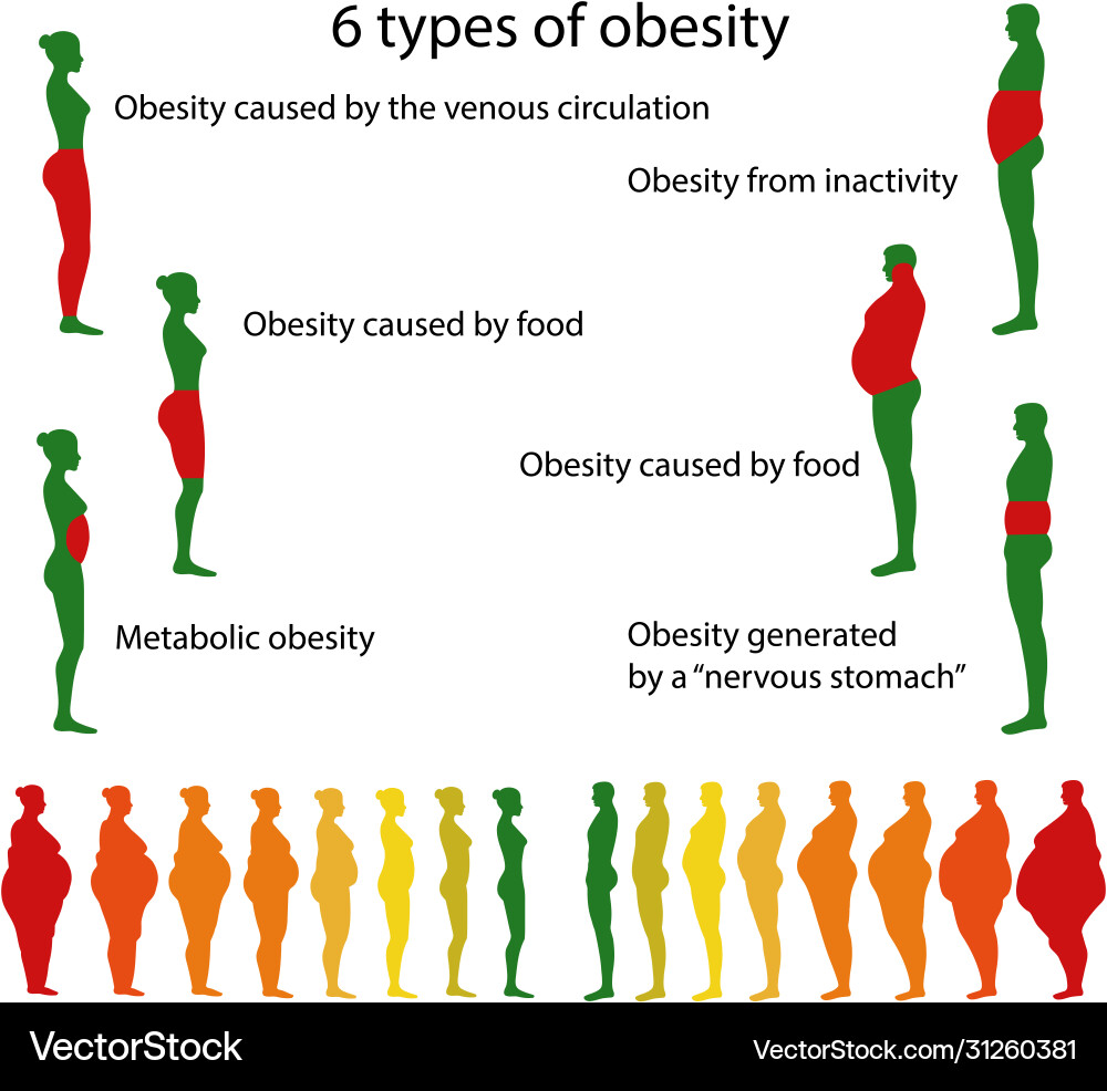 Obesity Royalty Free Vector Image - VectorStock
