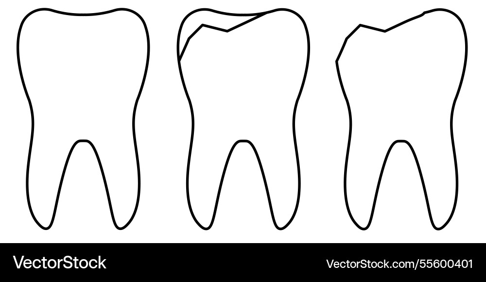 Healthy and damaged teeth outlines Royalty Free Vector Image
