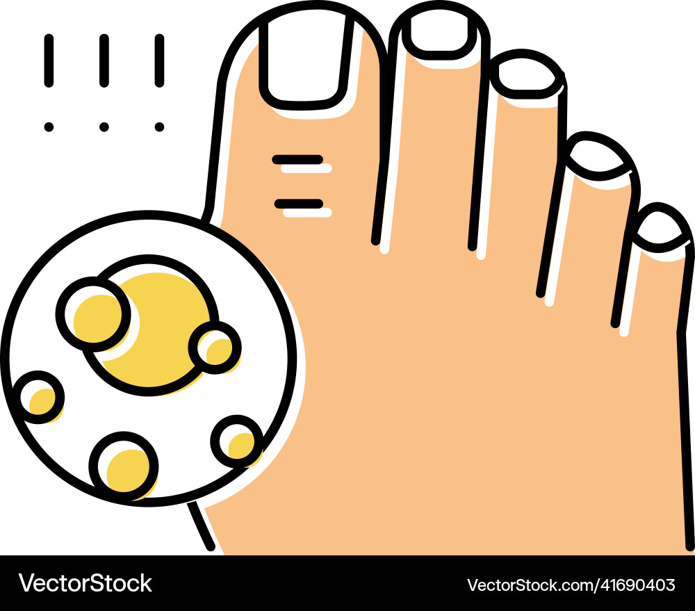 Uric acid crystals gout color icon Royalty Free Vector Image