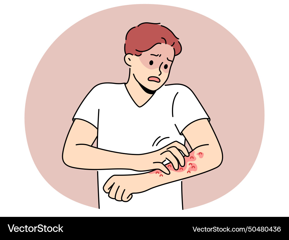 Unhealthy man scratch redness on arms Royalty Free Vector