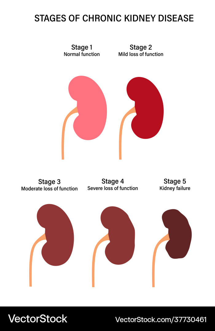 Kidney disease concept Royalty Free Vector Image