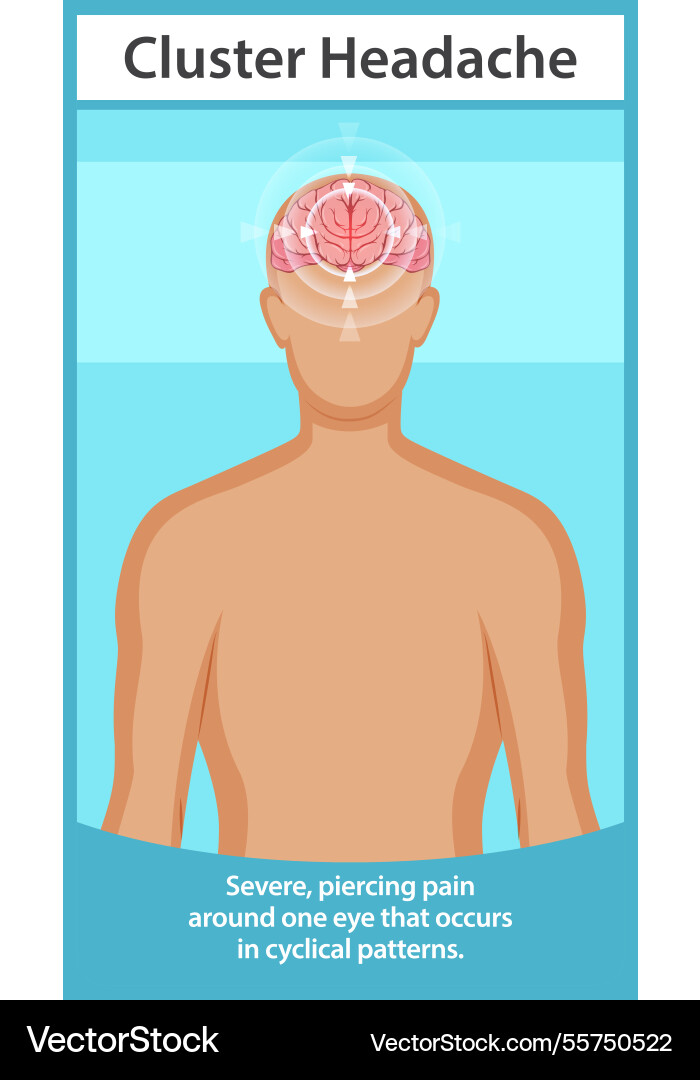 Cluster headache pain and patterns Royalty Free Vector Image