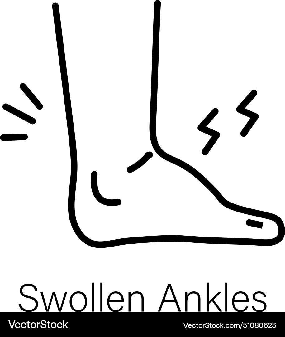 Swollen ankles Royalty Free Vector Image - VectorStock