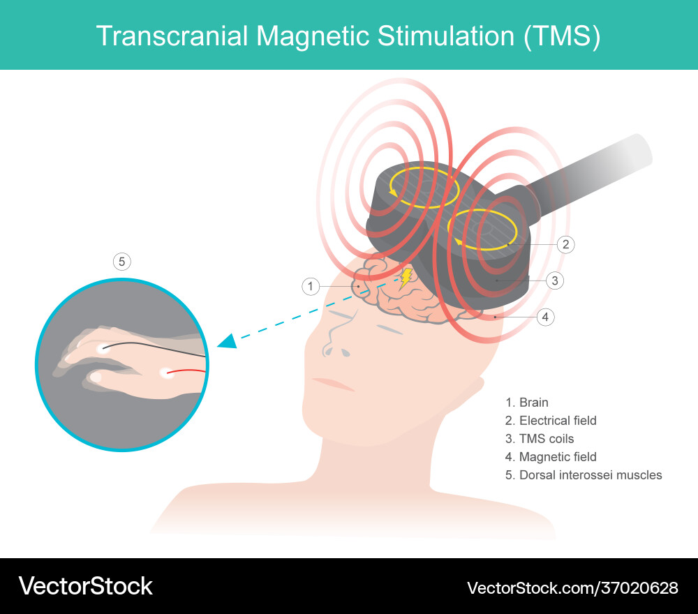 Transcranial magnetic stimulation tms brain Vector Image