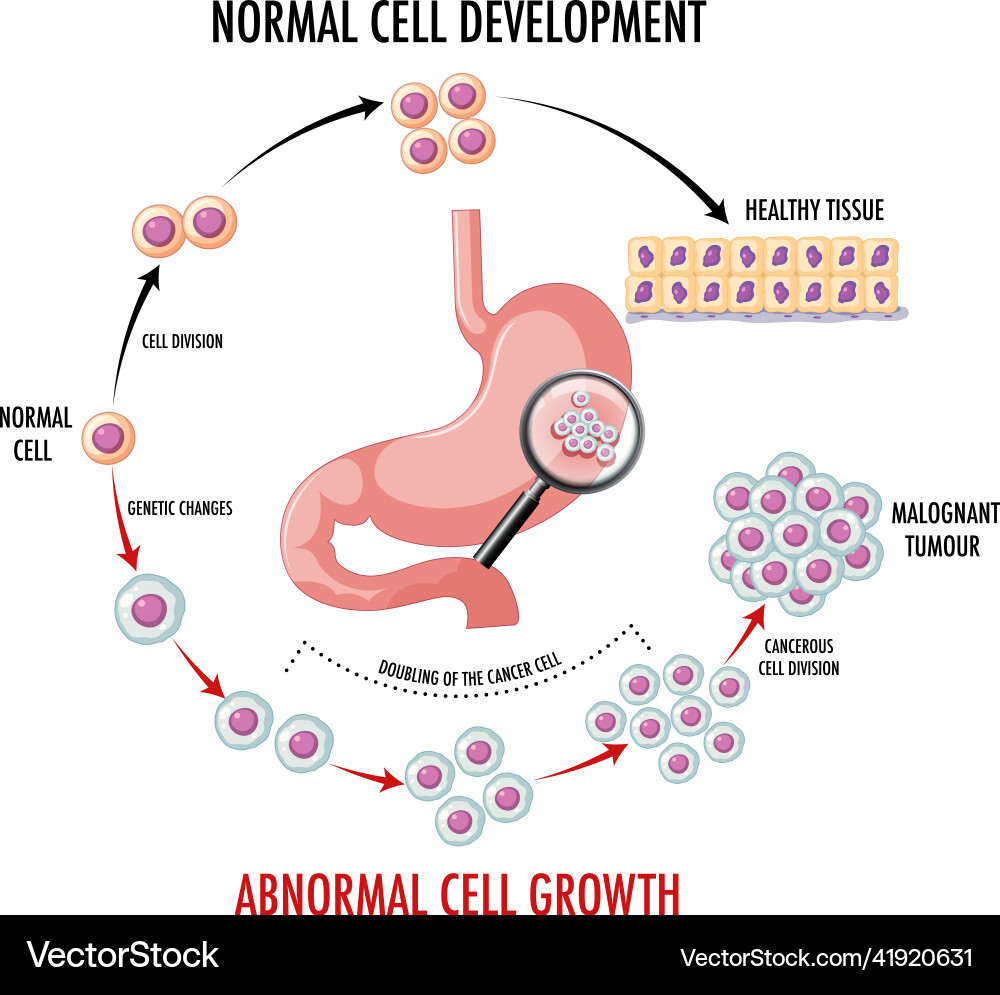 Diagram showing normal and cancer cells Royalty Free Vector