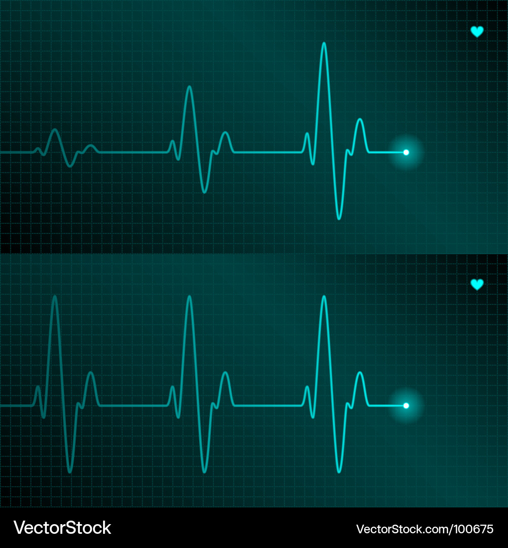Ekg Vector Images (over 11,000)