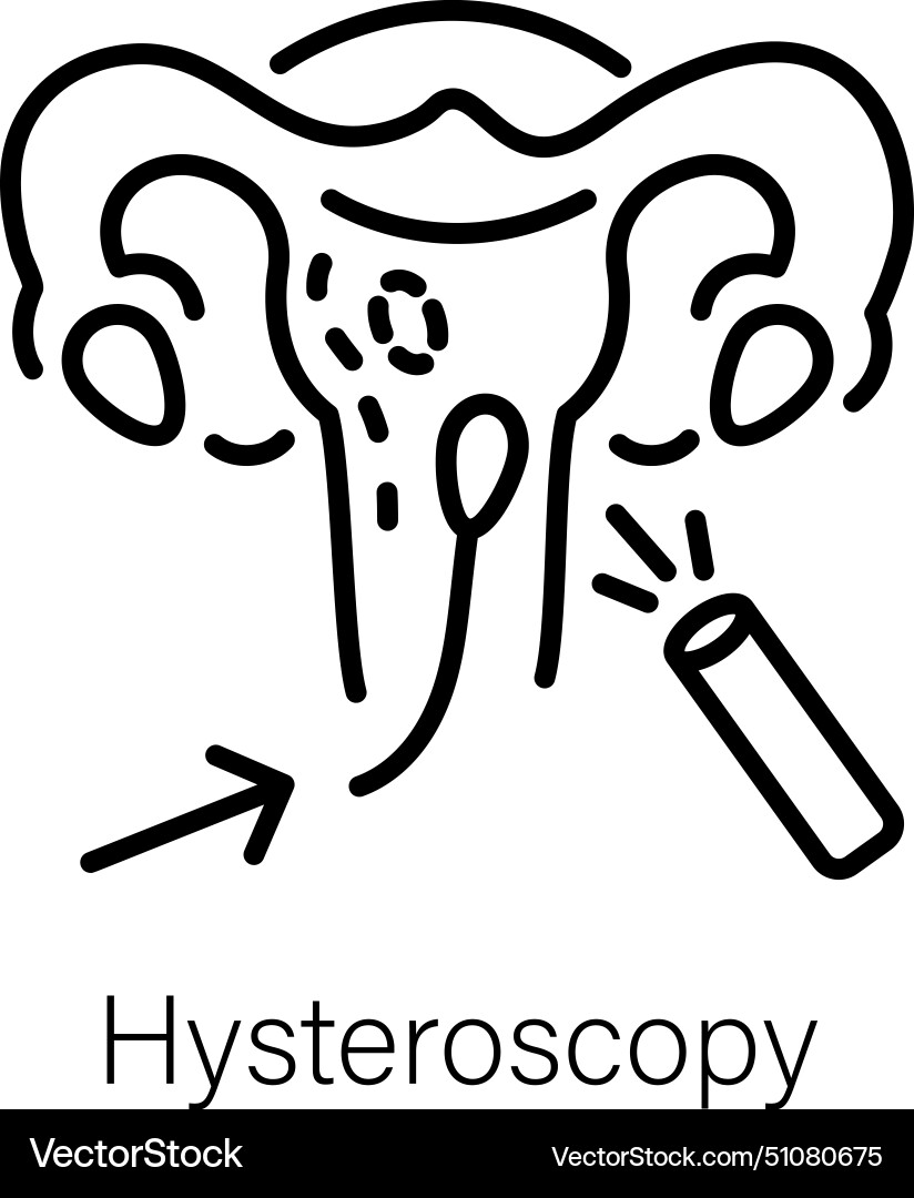 Hysteroscopy Royalty Free Vector Image - VectorStock