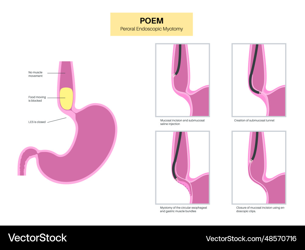Poem medical poster Royalty Free Vector Image - VectorStock