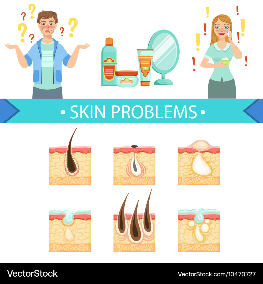 Skin problems infographic medical poster Vector Image