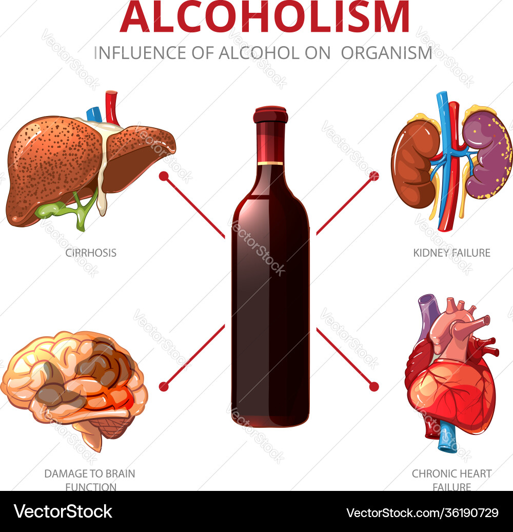 Long-term effects alcohol alcoholism Royalty Free Vector