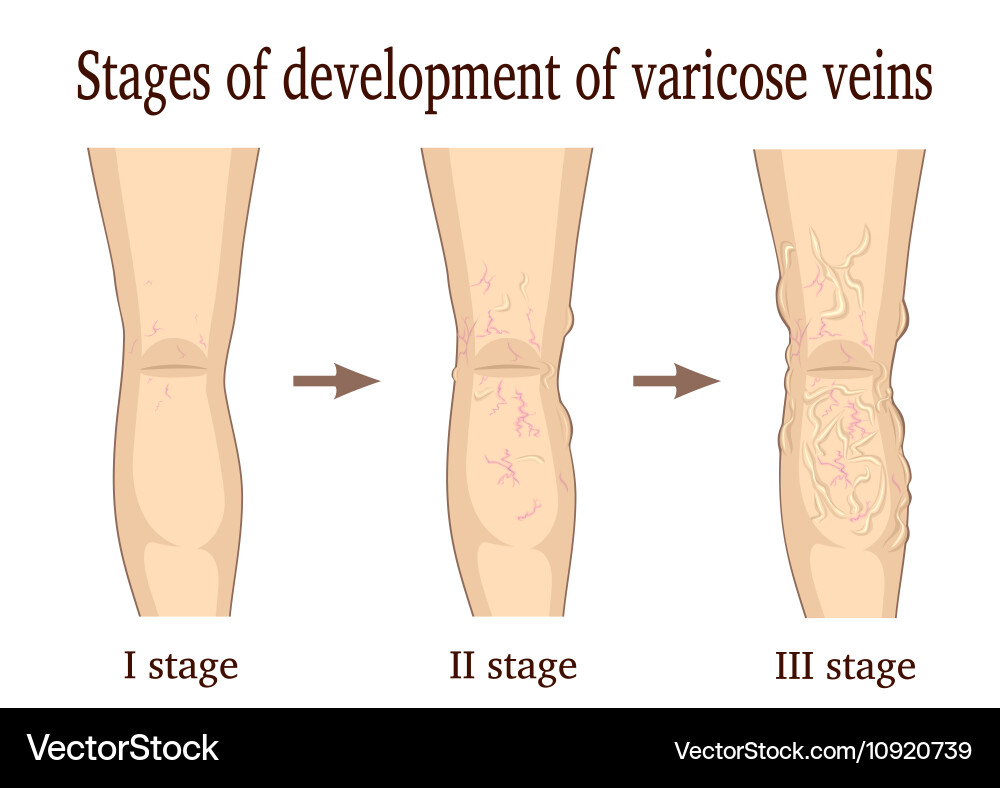 Simile Vector Images (over 180)
