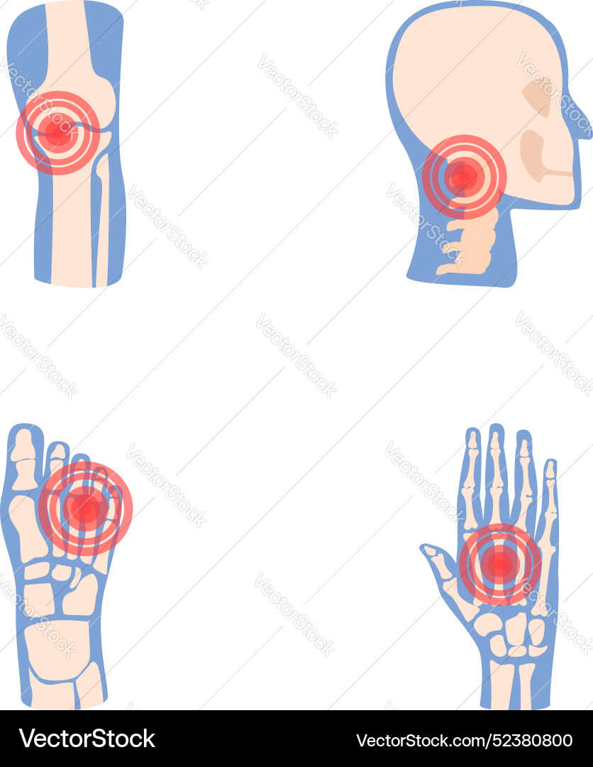 Joint disease icons set cartoon human Royalty Free Vector