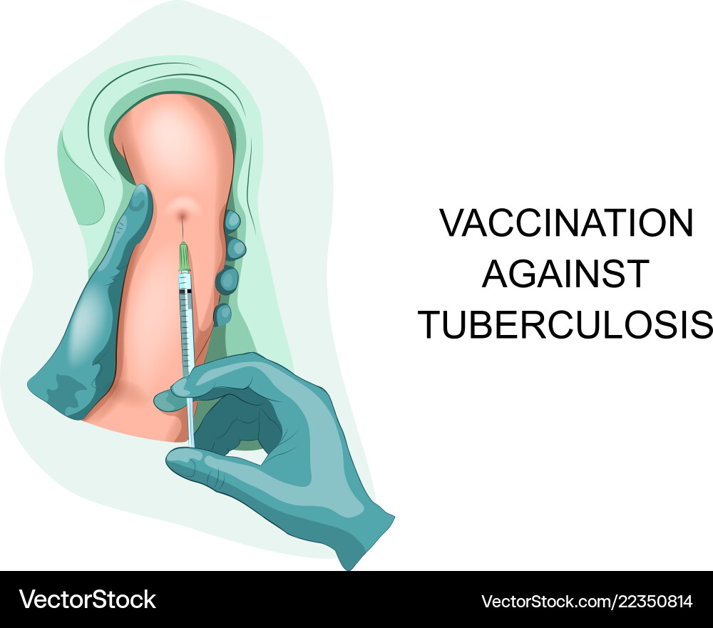 Vaccination against tuberculosis Royalty Free Vector Image
