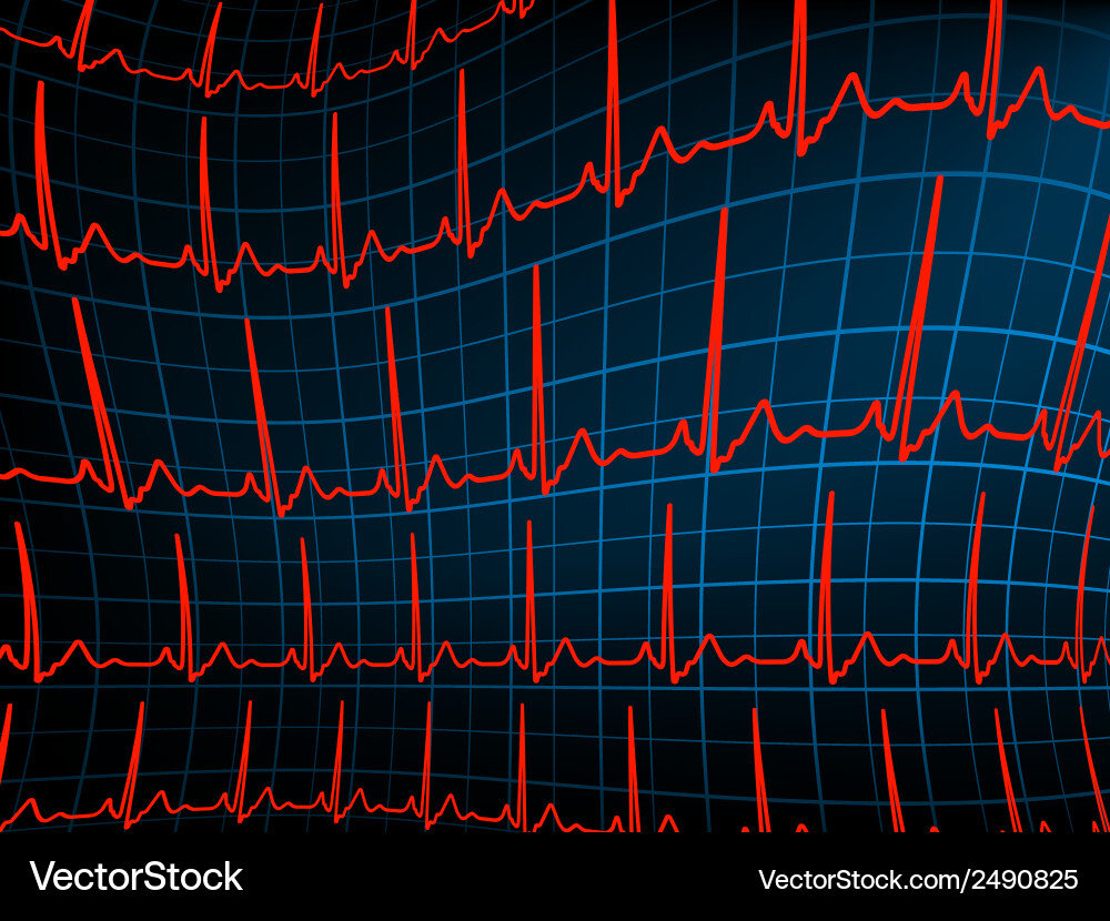 Ecg tracing monitor eps 8 Royalty Free Vector Image