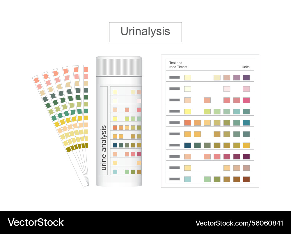 Eine Urinalyse ist ein einfacher Test der Urin prüft