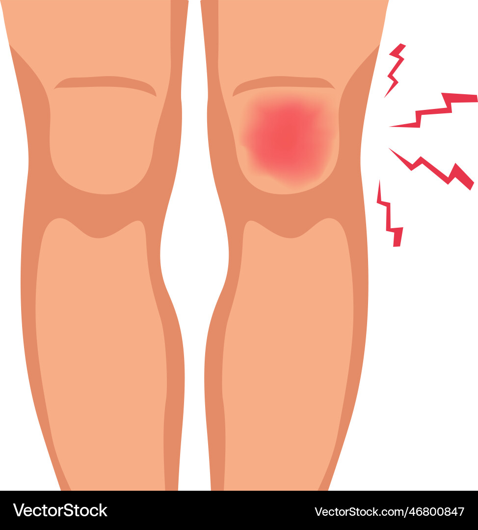Knee Injury Flat Vector Royalty Free Vector Image