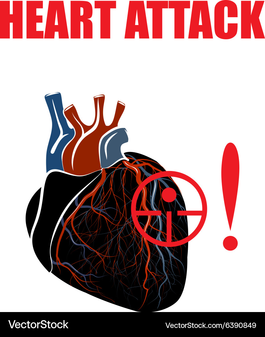 Heart myocardial infarction Royalty Free Vector Image