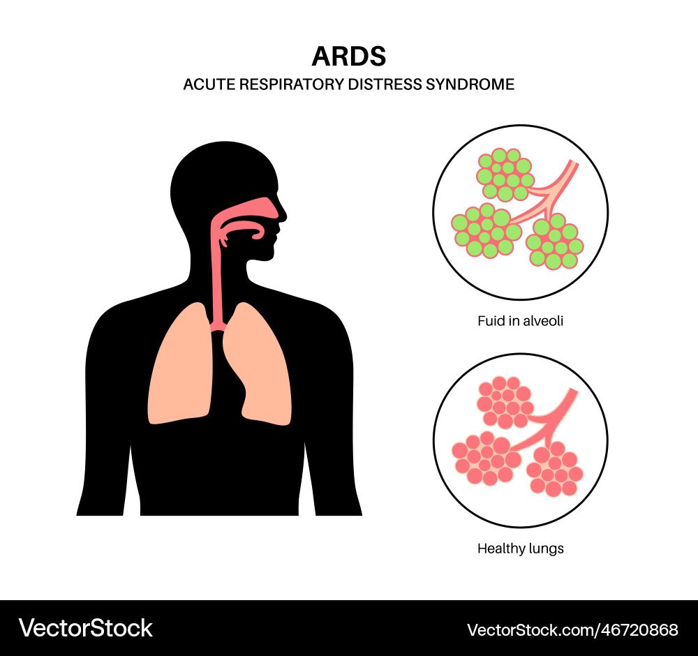Ards anatomisches Poster Lizenzfreies Vektorbild