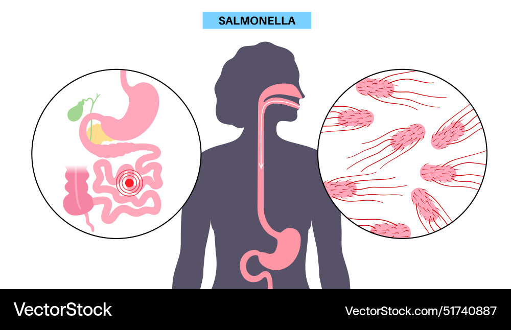 Salmonella typhimurium cells Royalty Free Vector Image