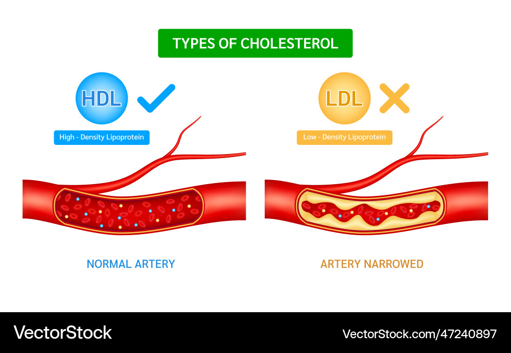 Types of cholesterol Royalty Free Vector Image