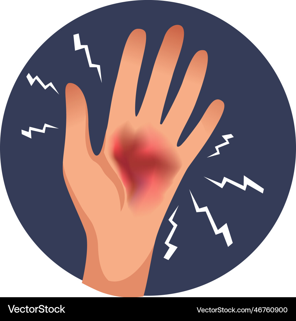 Hand Burn Pain Icon Royalty Free Vector Image - VectorStock
